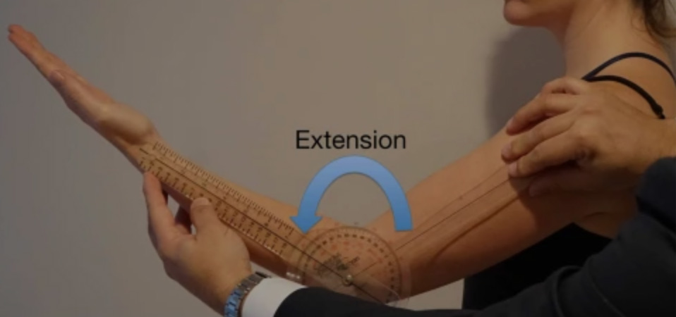 Elbow Contracture Release | Restore Motion & Relieve Stiffness